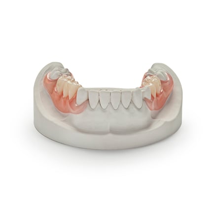 An In-Depth Look at DDS Lab Valplast® Partials