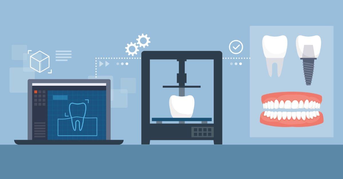 Intraoral Scanning for Removable Dentures