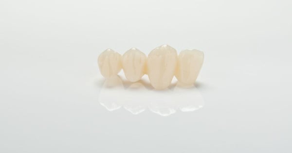 The Ultimate Dentist's Guide to Crown & Bridge