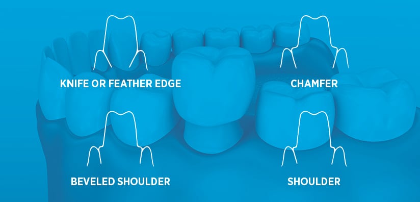 HOW TO IMPROVE YOUR MARGINS AND DIGITAL DENTAL SCANS
