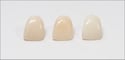 Zirconia crowns preparation guidelines