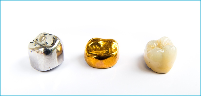 FULL CAST CROWNS & BRIDGES, PFMS AND ALL CERAMIC RESTORATIONS