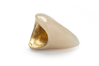 Full cast crown and bridge, PFMs and all-ceramic restorations