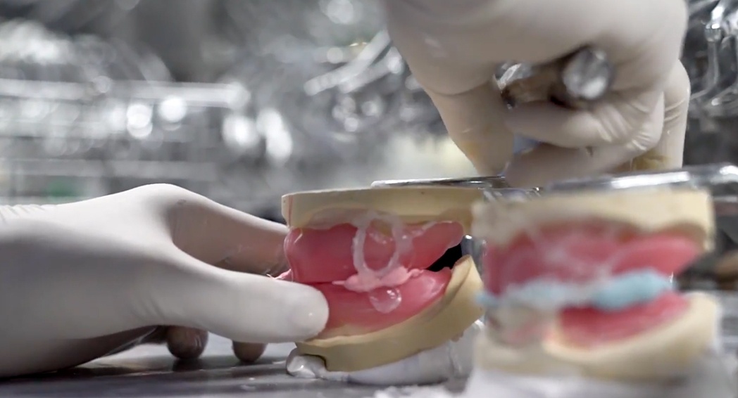 THE TEN STEPS TO DENTURE FABRICATION