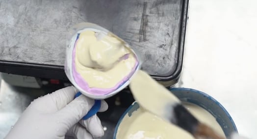 THE TEN STEPS TO DENTURE FABRICATION