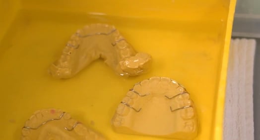 NINE STEPS TO CREATING A HAWLEY RETAINER