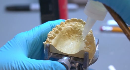 NINE STEPS TO CREATING A HAWLEY RETAINER