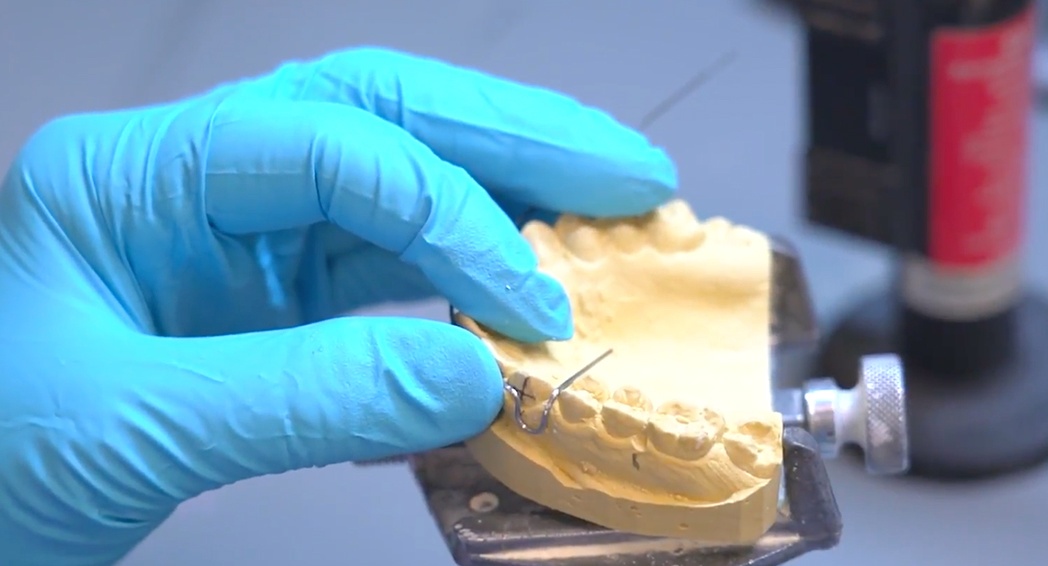 NINE STEPS TO CREATING A HAWLEY RETAINER