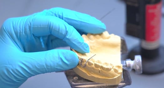 NINE STEPS TO CREATING A HAWLEY RETAINER