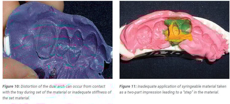 Most common dental impression errors and how to avoid them