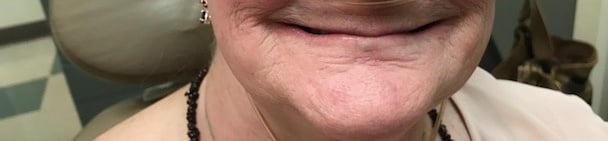 TIPS FOR A SUCCESSFUL DENTURE TEETH TRY IN