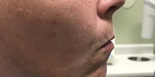 TIPS FOR A SUCCESSFUL DENTURE TEETH TRY IN