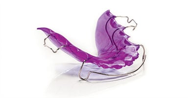 NINE STEPS TO CREATING A HAWLEY RETAINER