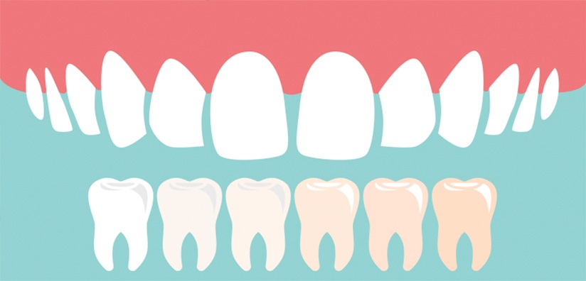 SHADE MATCHING: TIPS TO GET IT RIGHT
