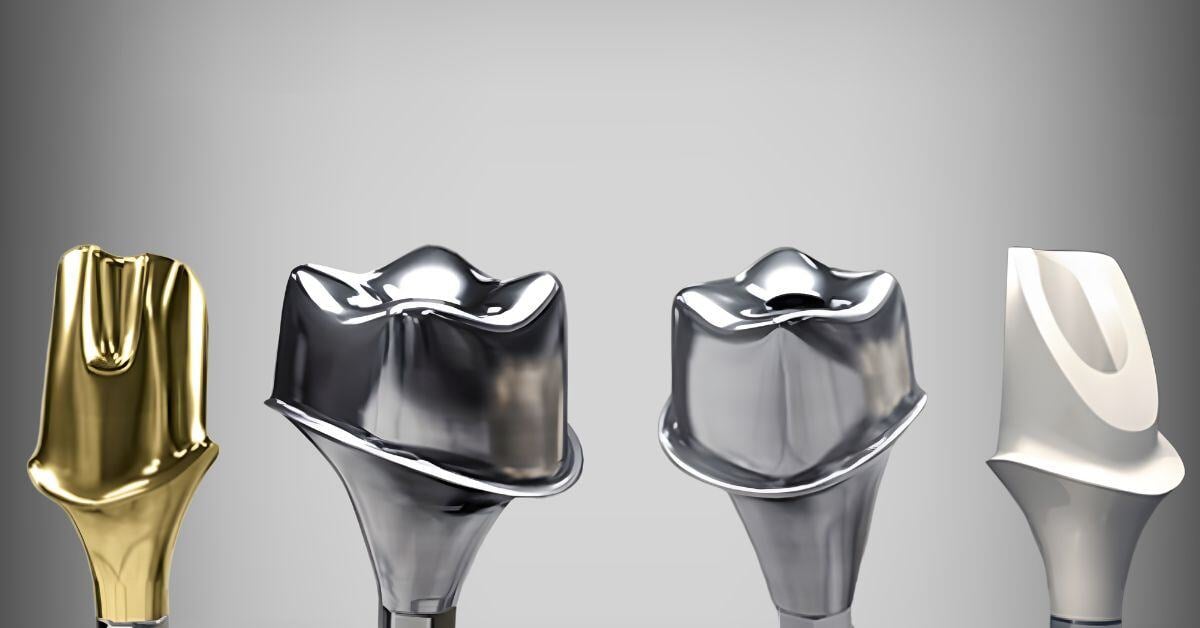 A Look at the Best Crown Based on Your Dental Implant Location