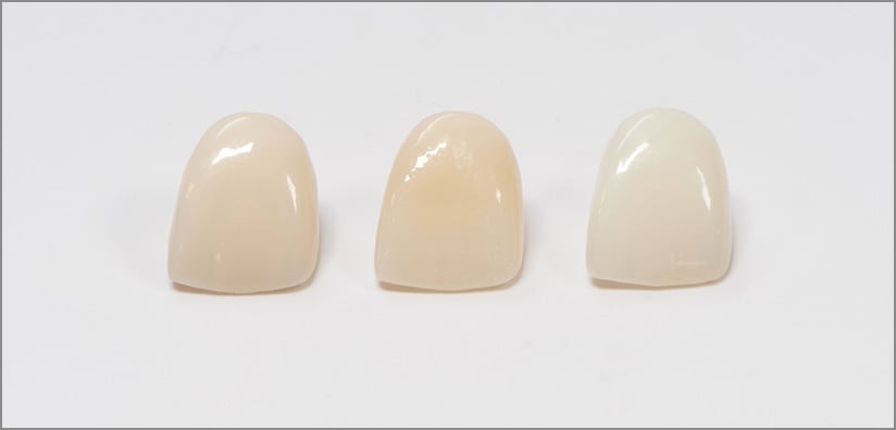 THE HISTORY OF ZIRCONIA IN DENTISTRY