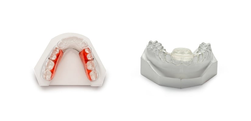 DENTAL SPLINTS: Materials, Benefits, and Features