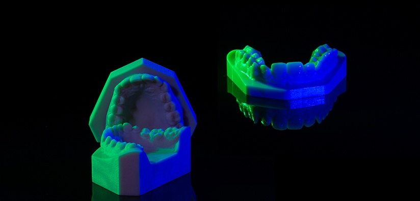 STUDY MODELS IN ORTHODONTICS