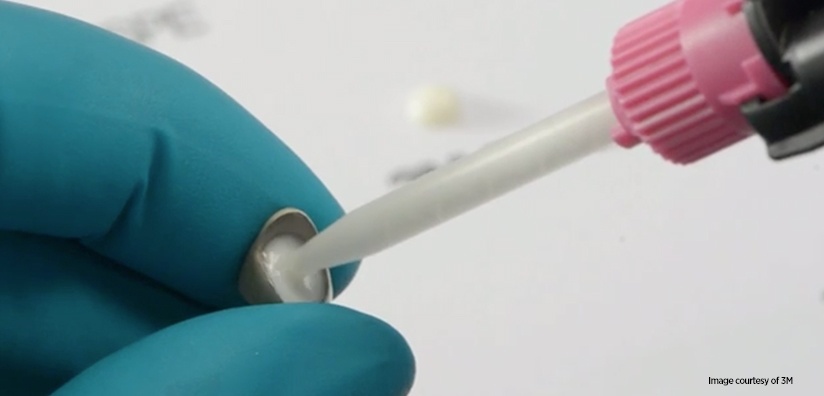 TIPS FOR CHOOSING LUTING AGENTS FOR ALL-CERAMIC CROWNS