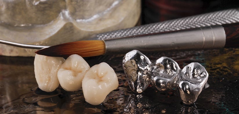 SMART MATERIALS IN DENTISTRY